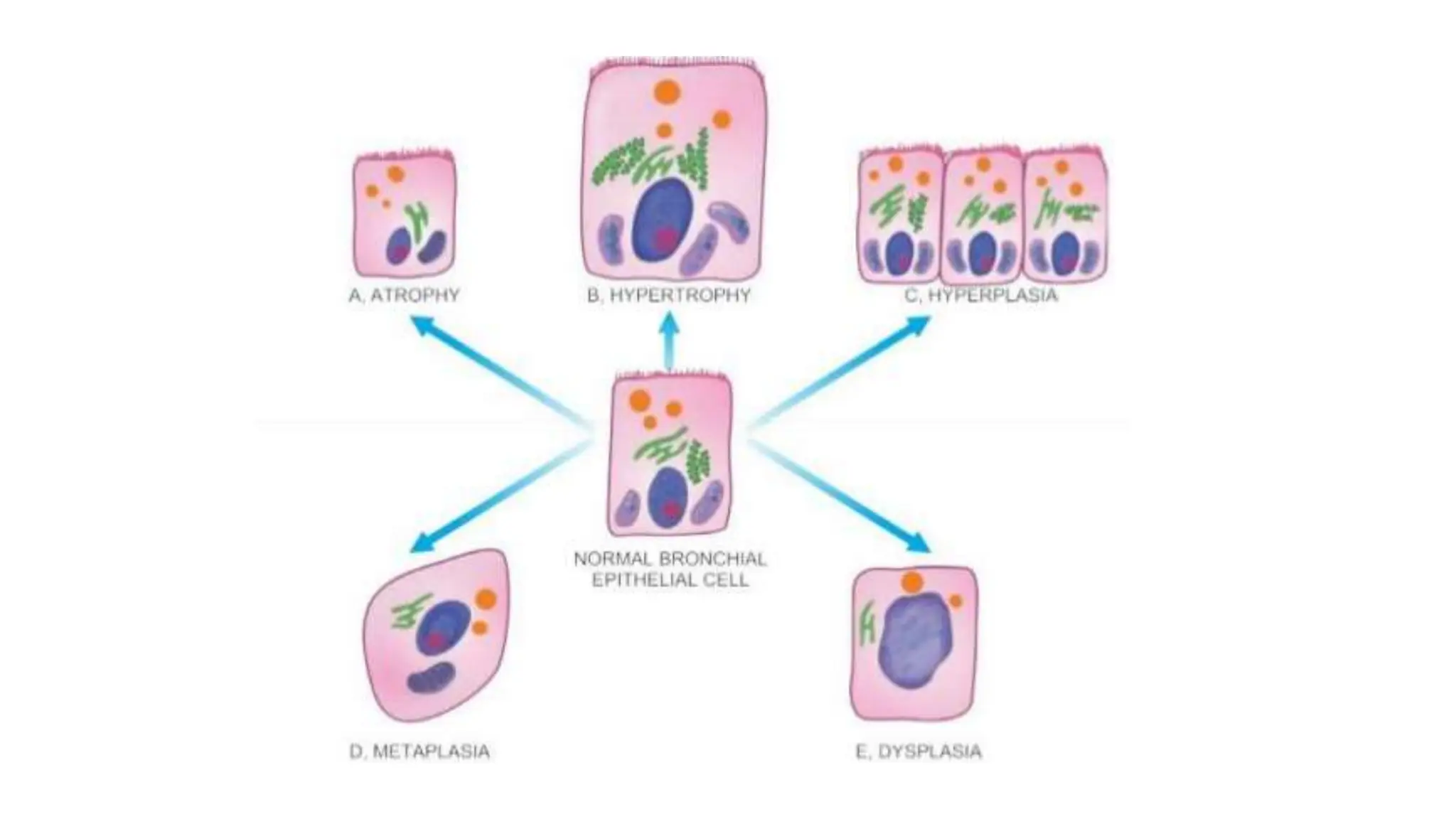 CELLULAR ADAPTATION AND ABERRANT CELL GROWTH [Autosaved].pptx