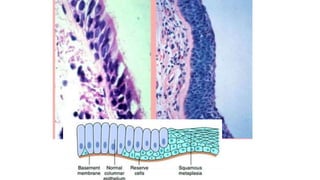 CELLULAR ADAPTATION AND ABERRANT CELL GROWTH [Autosaved].pptx