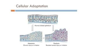 CELLULAR ADAPTATION AND ABERRANT CELL GROWTH [Autosaved].pptx