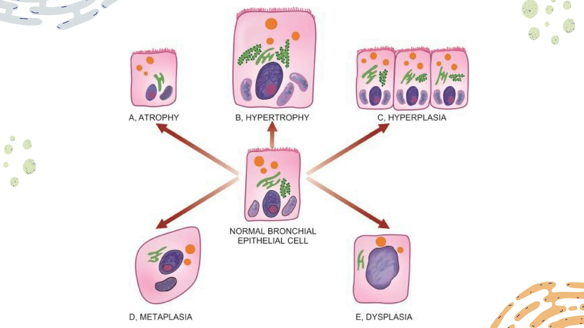 Cellular Adaptation & Cell Injury - Pathology | PDF