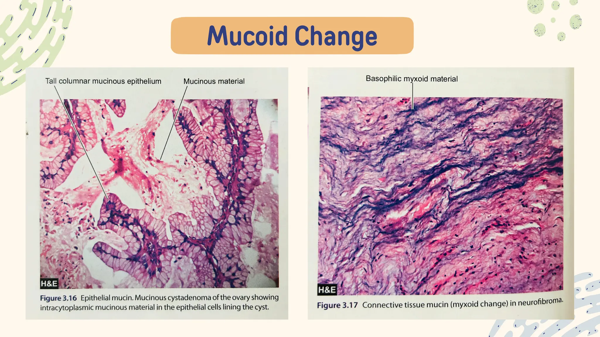 Cellular Adaptation & Cell Injury - Pathology | PDF