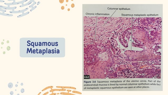Cellular Adaptation & Cell Injury - Pathology | PDF | Biological ...