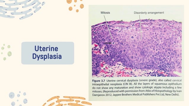 Cellular Adaptation & Cell Injury - Pathology | PDF | Biological ...