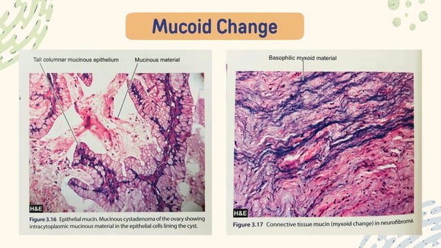 Cellular Adaptation & Cell Injury - Pathology | PDF | Biological ...