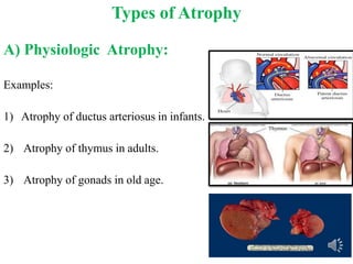 Cellular_adaptation_dr_AMAL_D_&_T_DR_AMAL_2023_lecture.pdf