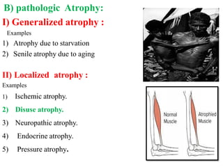 Cellular_adaptation_dr_AMAL_D_&_T_DR_AMAL_2023_lecture.pdf