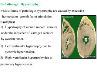 Cellular_adaptation_dr_AMAL_D_&_T_DR_AMAL_2023_lecture.pdf
