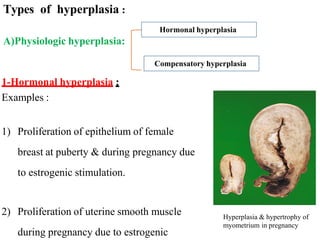 Cellular_adaptation_dr_AMAL_D_&_T_DR_AMAL_2023_lecture.pdf