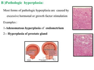 Cellular_adaptation_dr_AMAL_D_&_T_DR_AMAL_2023_lecture.pdf