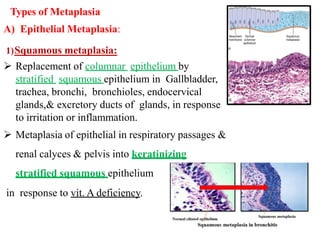 Cellular_adaptation_dr_AMAL_D_&_T_DR_AMAL_2023_lecture.pdf