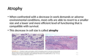 Cellular Adaptation, injury and death.pptx