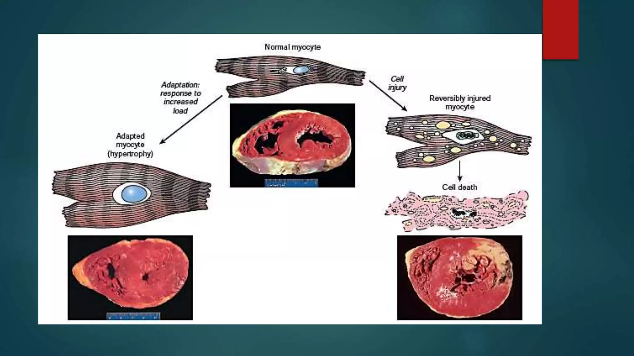 Cellular adaptations | PPT