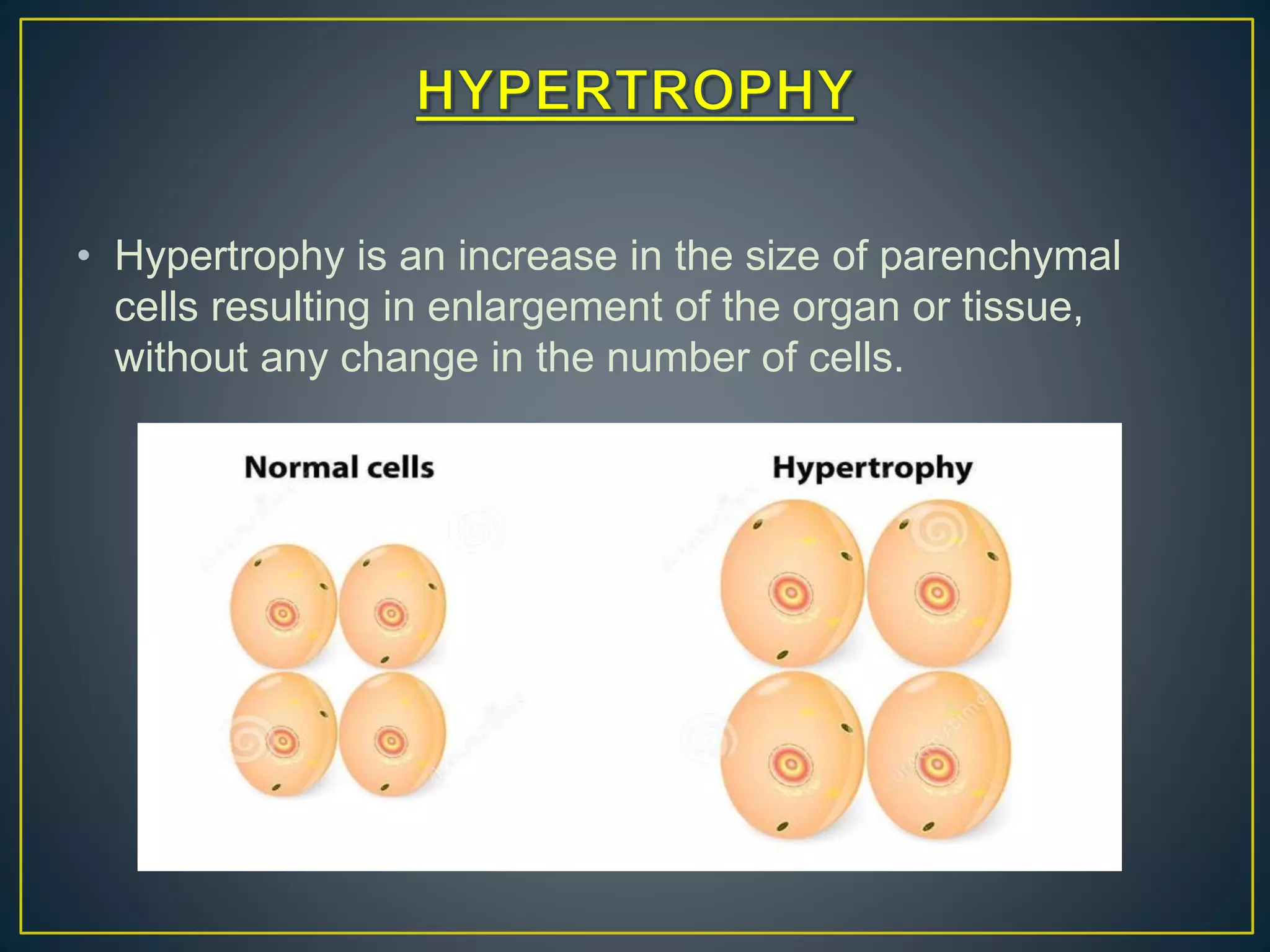 Cellular adaptations | PPTX