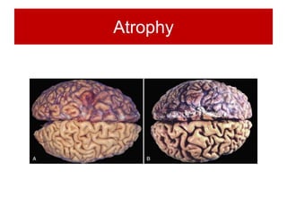 Cellular adaptations | PPT