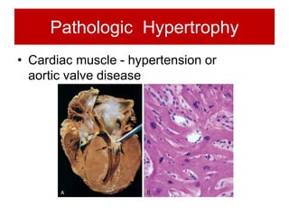 Cellular adaptations | PPT