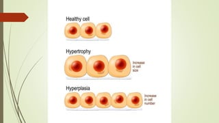 Cellular adaptations.pathology slideshare.pptx