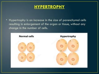 Cellular Adaptations for the student of paramedical | PPT