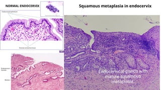 Cellular adaptations - hyperplasia, hypertrophy | PPTX