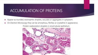 Cellular adaptations & accumulations | PPT