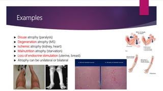 Cellular adaptations & accumulations | PPT