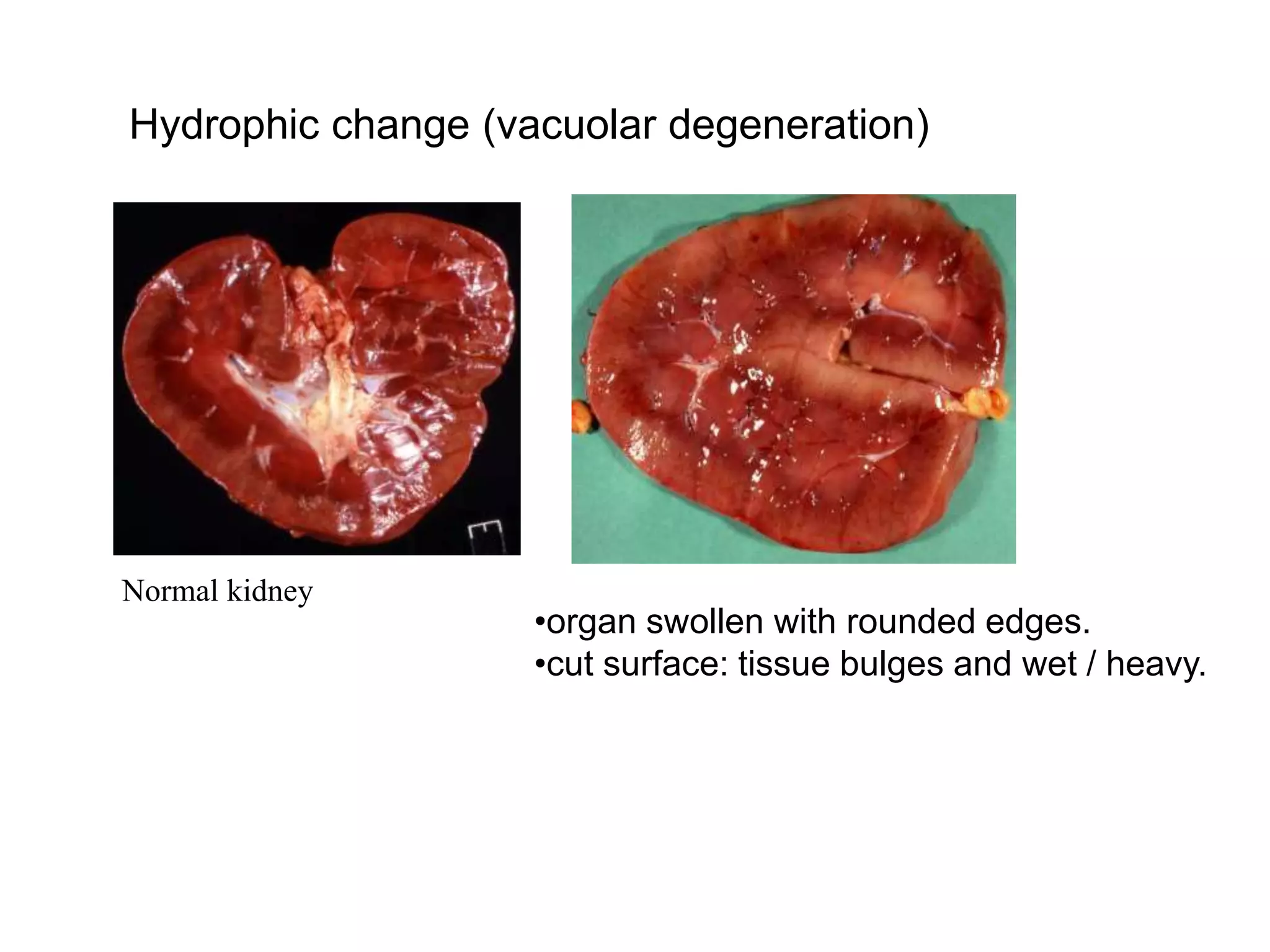 Cellular injury - intoductory pathology to disease | PPT