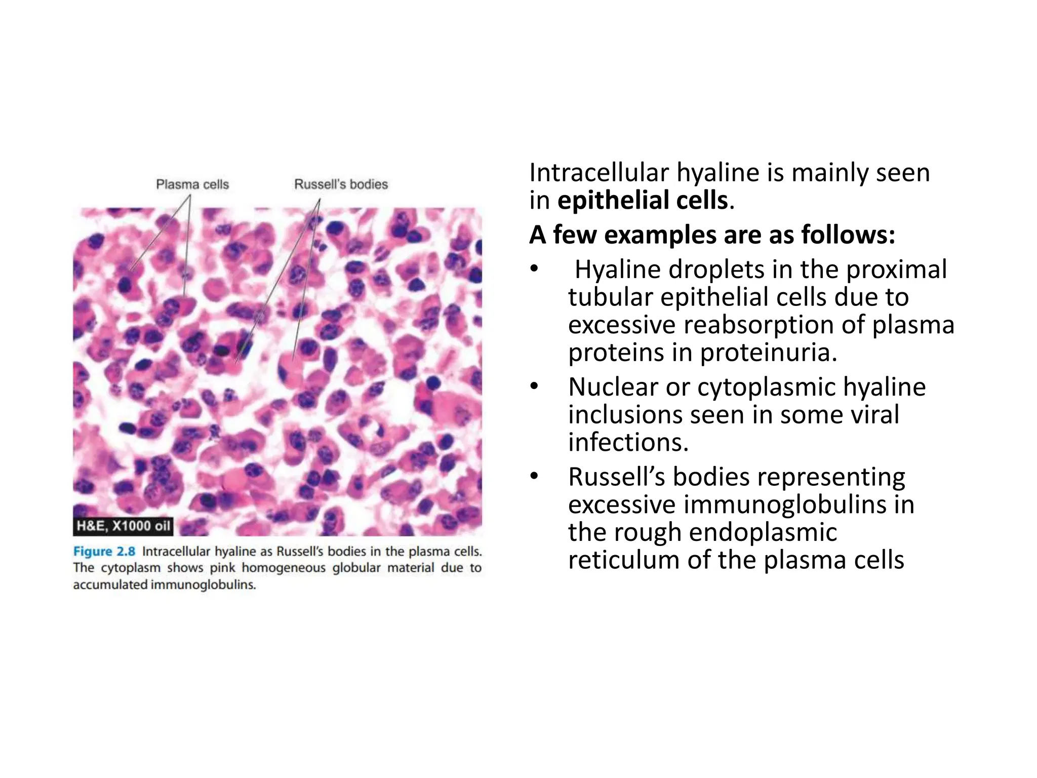 Cellular Injury and cellular adaptations | PPTX