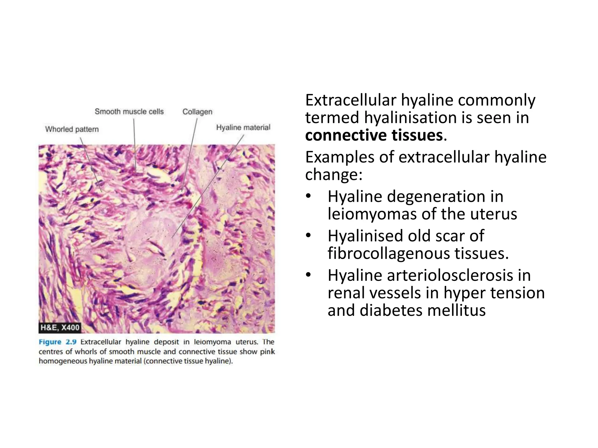 Cellular Injury and cellular adaptations | PPTX