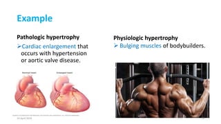 Cellular injury and adaptation | PPTX