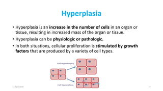 Cellular injury and adaptation | PPTX