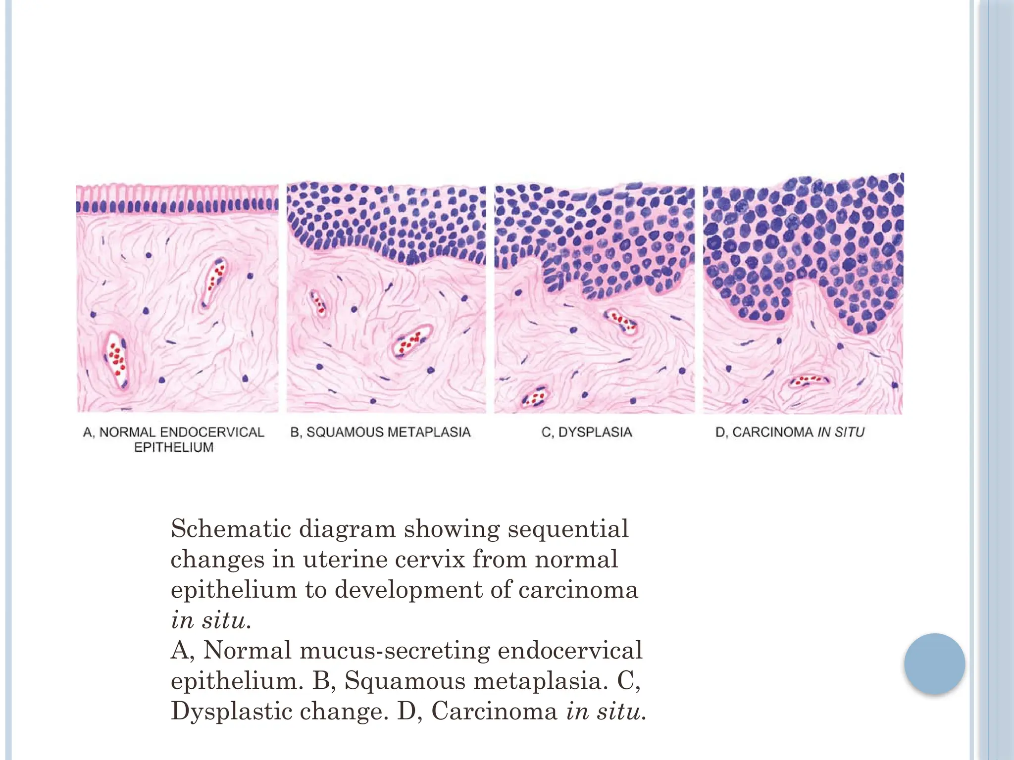 cellular reactions to injury (PATHOLOGY) | PPTX