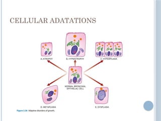 cellular reactions to injury (PATHOLOGY) | PPTX