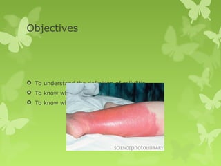 Cellulitis | PPT