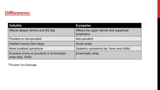 Cellulitis - Treatment | PPTX