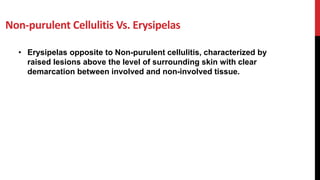 Cellulitis - Treatment | PPTX