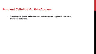 Cellulitis - Treatment | PPTX