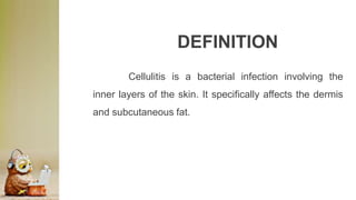 Cellulitis | PPT