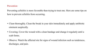 Cellulitis | PPTX