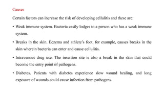 Cellulitis | PPTX