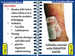 Cellulitis by Dr.K.AmrithaAnilkumar | PPTX