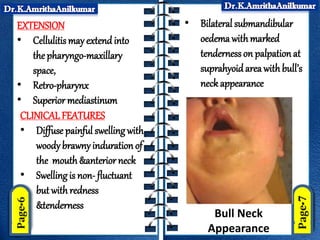 Cellulitis by Dr.K.AmrithaAnilkumar | PPT