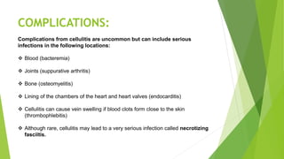 Cellulitis | PPTX