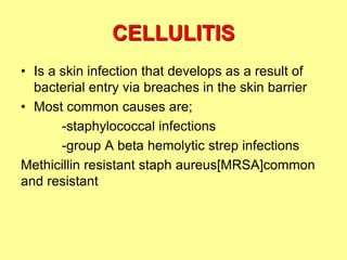 cellulitis.ppt
