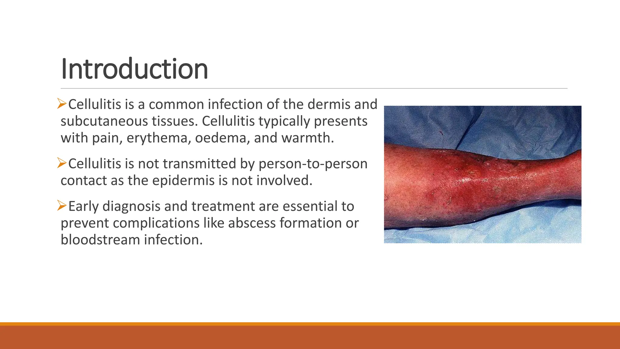 Cellulitis- Causes, Diagnosis and its Management. | PPTX