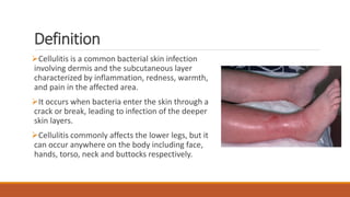 Cellulitis- Causes, Diagnosis and its Management. | PPTX | Skin and ...