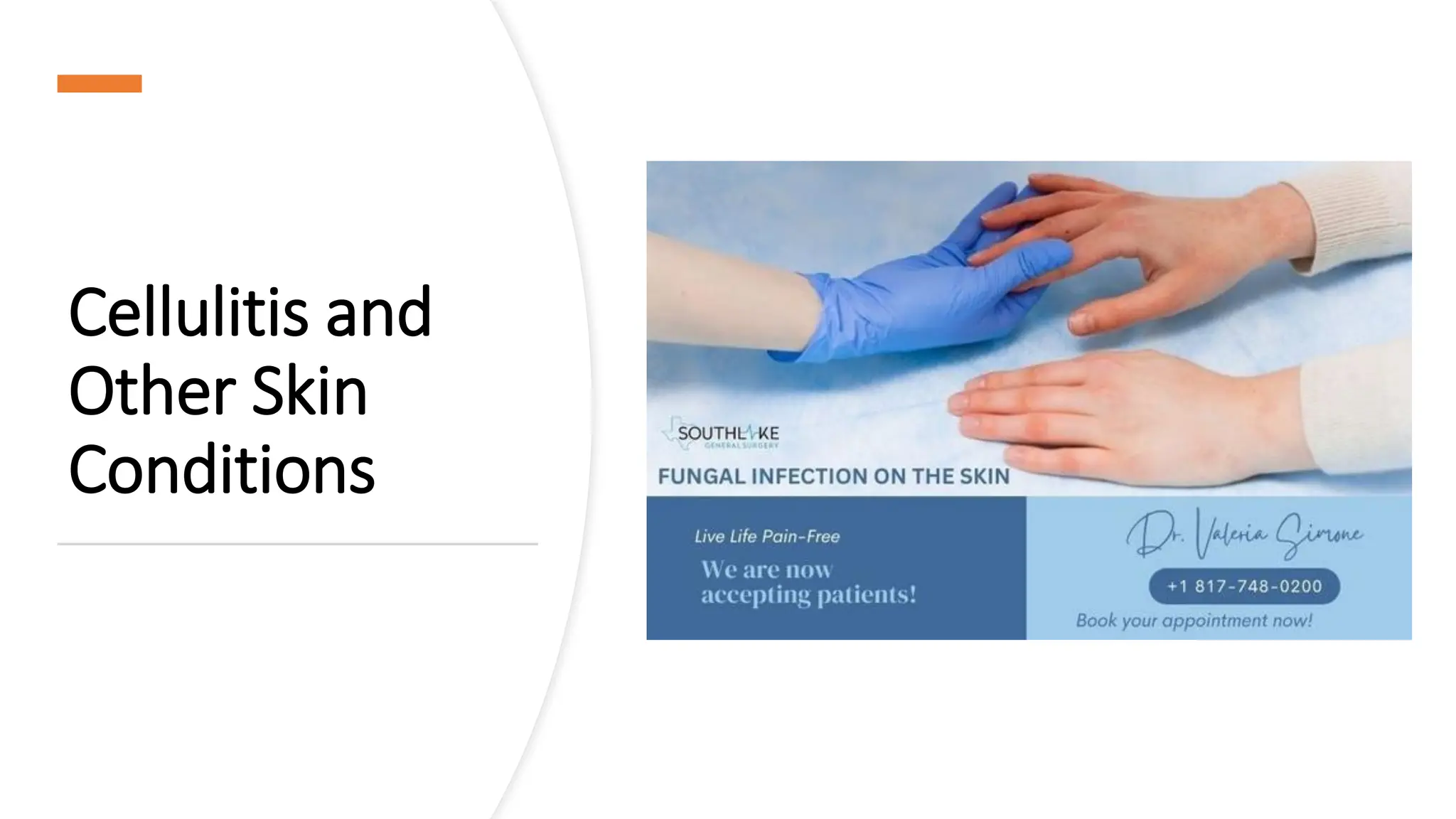 Cellulitis - Causes, Treatments, and Recovery.pdf