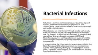 Cellulitis - Causes, Treatments, and Recovery.pdf