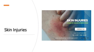 Cellulitis - Causes, Treatments, and Recovery.pdf