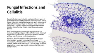 Cellulitis - Causes, Treatments, and Recovery.pdf