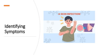 Cellulitis - Causes, Treatments, and Recovery.pdf