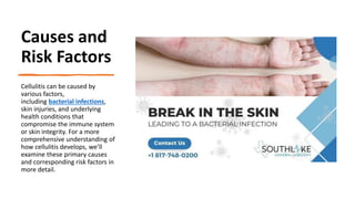 Cellulitis - Causes, Treatments, and Recovery.pdf